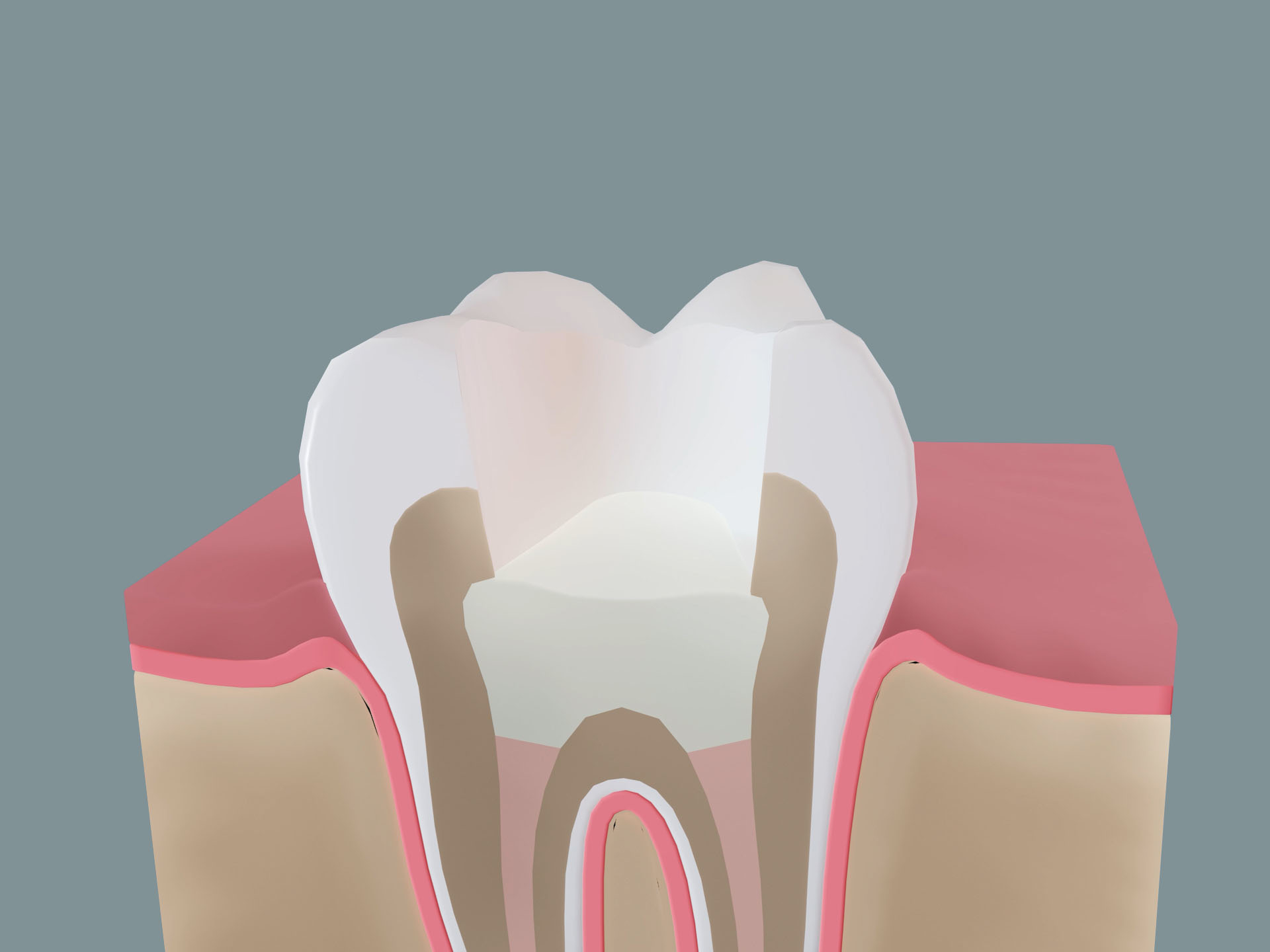 No Need to Fear: Root Canal Therapy Explained - Denton Dental Group